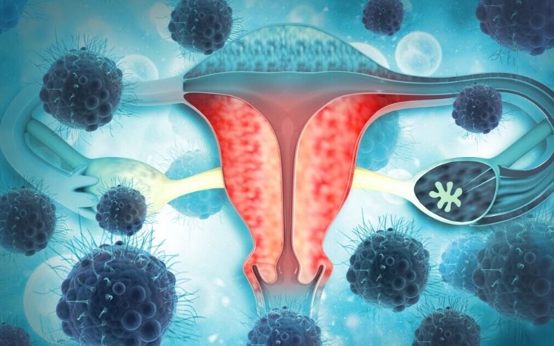 NV | Conoce los primeros síntomas que puede manifestar el cáncer de útero